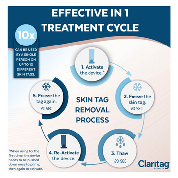 How to Use Claritag® – Easy Skin Tag Removal at Home